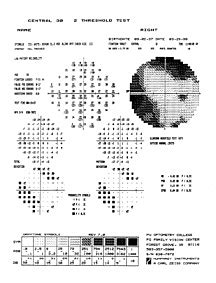 Visual Field Testing