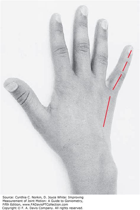 Finger Range Of Motion Chart Ponasa