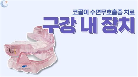 코골이 수면무호흡증의 비수술 치료 방법 구강 내 장치 알아보기 Youtube