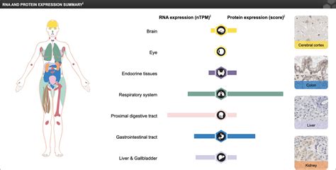 Transcriptomics Runx1 And Juvenile Idiopathic Arthritis