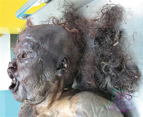 Putrefaction With Skin Slippage R Nsfl