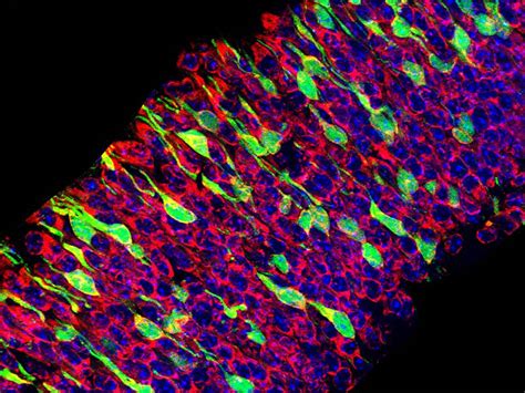 Small Head Syndrome In Adults Clinicspots