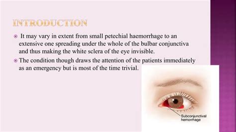 Subconjunctival Haemorrhagecausestreatmentpptx Eye And Vision