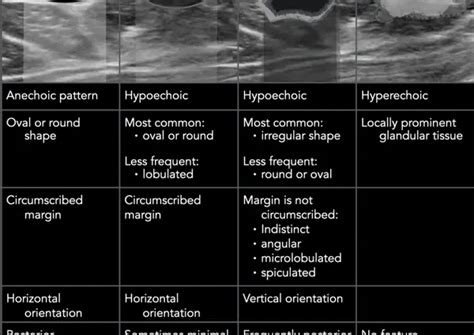 Breast Ultrasound How To Interpret The Results Healthy Food Near Me