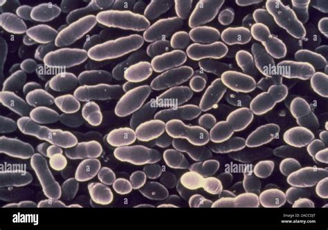 Scanning Electron Micrograph SEM Of A Colony Of Bacillus Anthracis