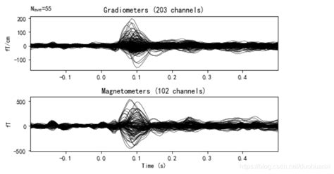 脑机接口基础学习03 认识及创建epocheeg Epoch Csdn博客
