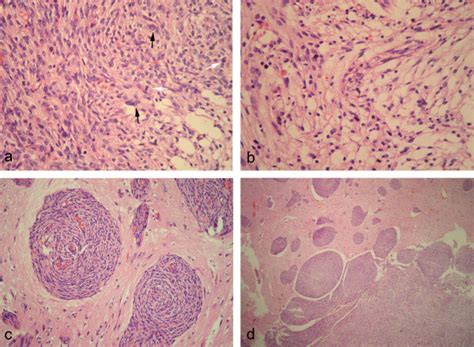 Histopathological Findings Of Lesion A Photomicrographs Showed That