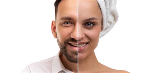 Cuánto vale una reasignación de sexo en Colombia Lo puede cubrir la EPS