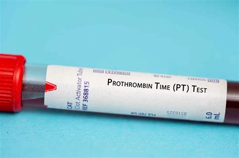 Cek Prothrombin Time Pt Pengertian Manfaat Dan Prosedur Halodoc