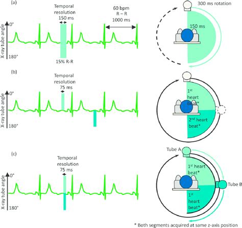 Temporal Resolution In Cardiac Ct Scanning A With A Half Scan Download Scientific
