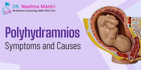 Polyhydramnios Symptoms And Causes Dr Neelima Mantri