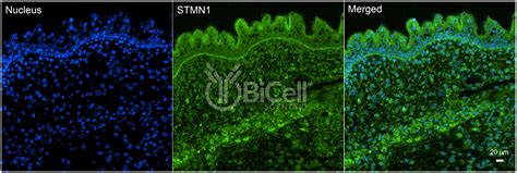 Stathmin Stathmin 1 Or Stmn1 Antibody Bicell Scientific®