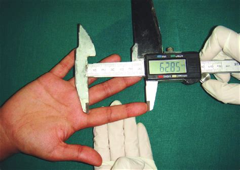 Measurement Of Length Of Index Finger Download Scientific Diagram