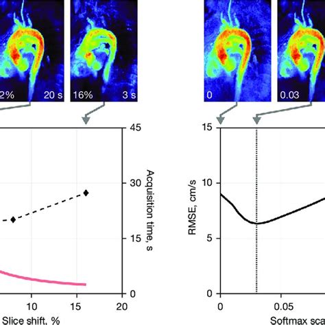 Mvp Of The Aortic Arch Left To Right Single Systolic Speed Map Mean