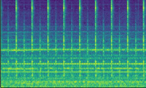 Examples Of Normal And Abnormal Samples In The Dataset Download