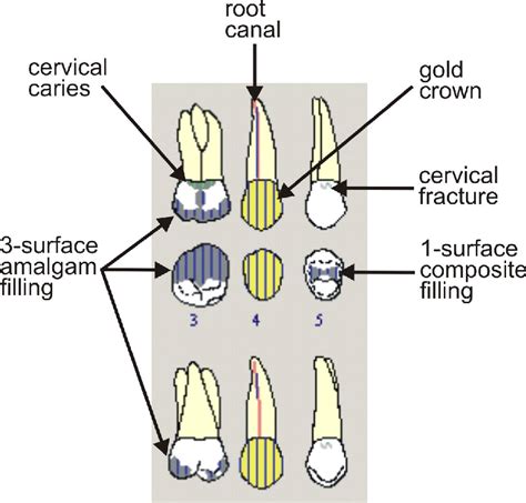 Types Of Dental Charting Printable Forms Free Online