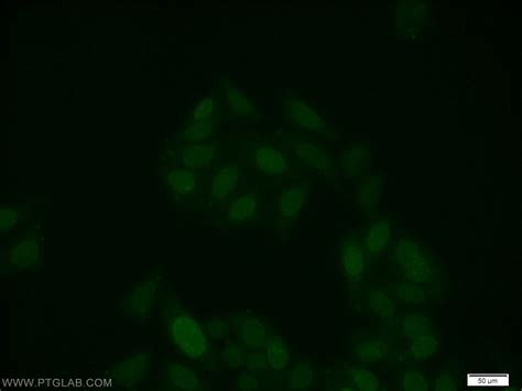 RUNX Middle Antibody AP Proteintech