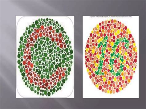 Basic Patterns Of Inheritance Biology Pptx Ppt