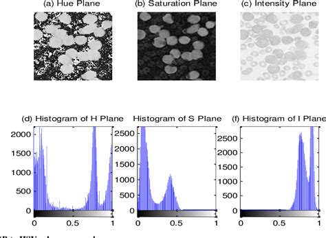 Figure 1 From Automated Leukemia Detection Using Shape Feature Extraction Semantic Scholar