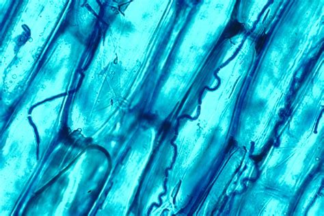 34 Facts About Endophytes