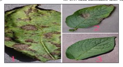 Figure 1 From Early Blight And Late Blight Disease Detection In Potato Using Efficientnetb0
