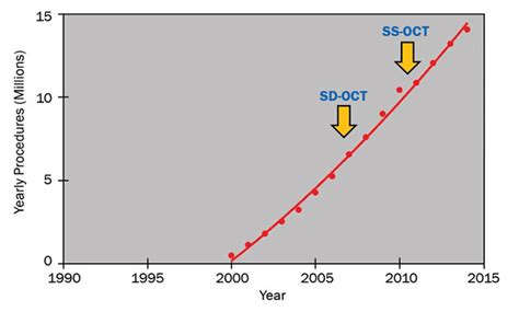 Advances In Optical Coherence Tomography Features Oct Photonics Spectra