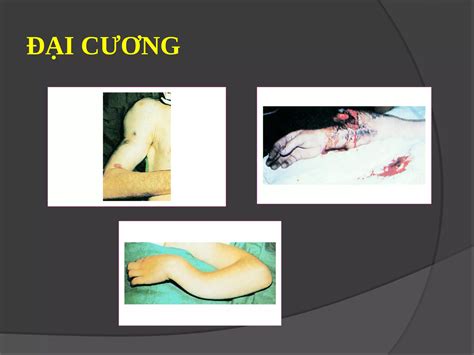 B I Gi Ng C Nh G Y X Ng Pdf