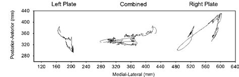 Example Of Cop Excursion Data Recorded From Force Plates Left Plate Download Scientific