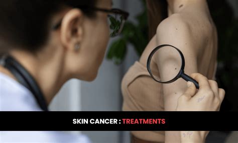 Unveiling Effective Skin Cancer Treatments A Comprehensive Guide
