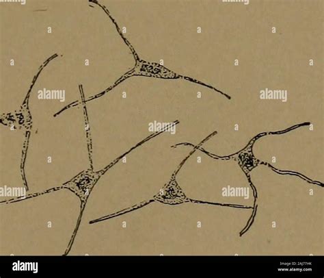 Reticular Fibers Vs Elastic Fibers