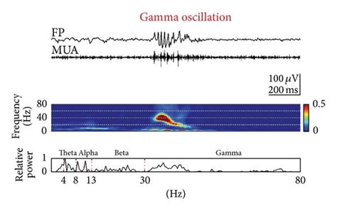 Properties Of Spontaneous Spindle Bursts And Gamma Oscillations A Download Scientific