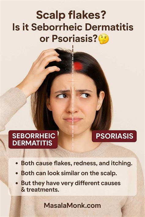 Scalp Psoriasis Vs Seborrheic Dermatitis Differences And Treatment
