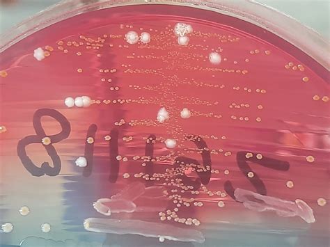 Mdr Eskape Introduction Group Of Pathogens Clinical Importan