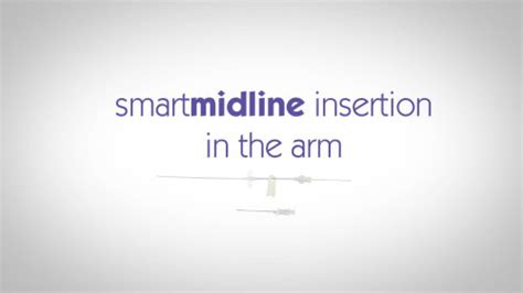 Smartmidline Midline Direct Seldinger Vygon