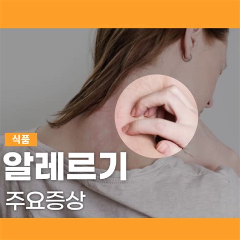 유아 우유알레르기 및 식품알레르기 증상 피부두드러기기침천식비염까지 네이버 포스트