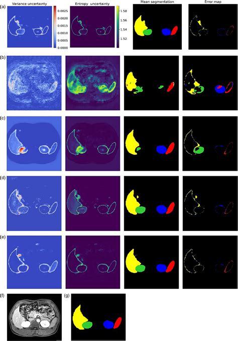 histogram matching‐enhanced adversarial learning for unsupervised domain adaptation in medical