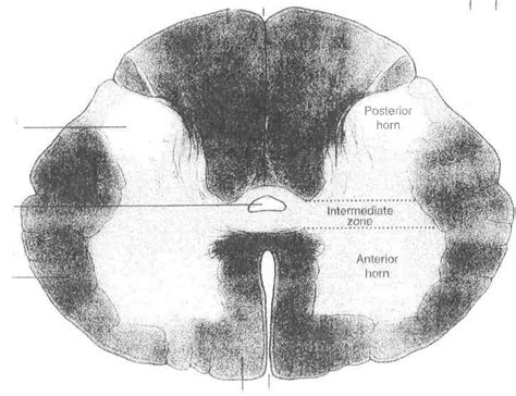 Posterior Intermediate Sulcus