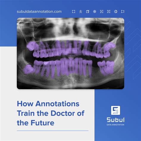 Subul Data Annotation On Linkedin Medtech Ai Healthcare Machinelearning Datascience