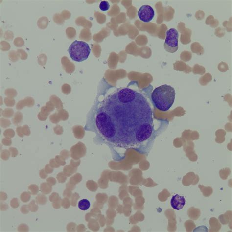 Pawn Ball Megakaryocytes