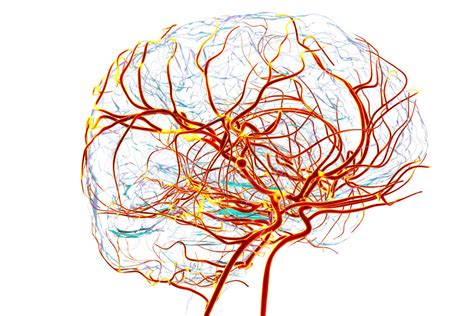 Intracranial Haemorrhage Detection Using Ai Open Medscience