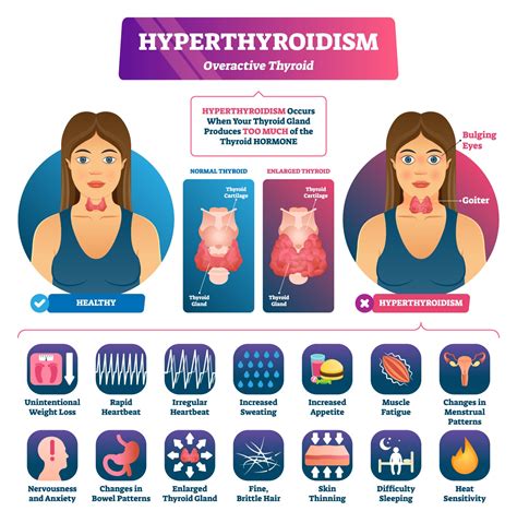 Why How Thyroid Affects Woman Thyroid Enlarged Thyroid Thyroid My Xxx Hot Girl