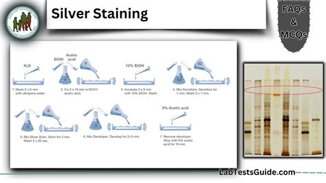 Silver Staining 50 Faqs And 30 Mcqs