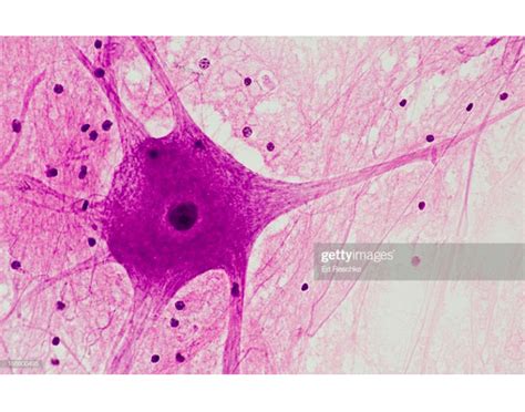 Identify Microscope Of A Neuron Quiz