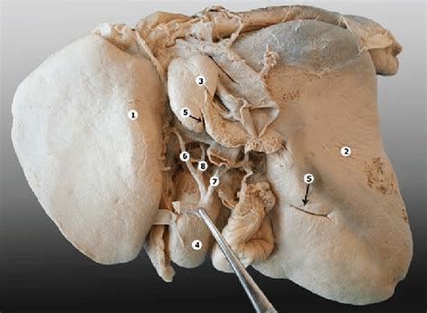 A Fissure That Divides The Caudate Lobe Of The Liver 1 Left Liver