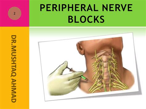 Peripheral Nerve Blocks 1 By Drmushtaq Pptx
