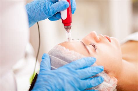 미용실에서 아름답고 젊은 여성의 얼굴 피부의 미세 피부 절차를 만드는 미용사 20 24세에 대한 스톡 사진 및 기타 이미지 20 24세 20 29세 2명 Istock