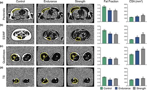 Fat Signal Fraction Fat Fraction And Cross‐sectional Area Csa In
