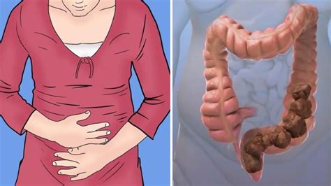 Натуральное слабительное Со Вкусом