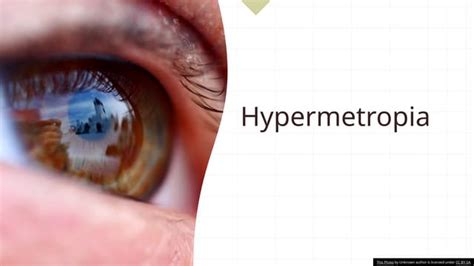 Hypermetropia Intro Causes Types Symptoms And Management Pptx