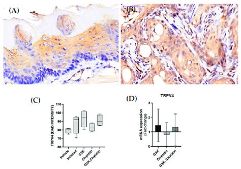 Photomicrographs Of Trpv4 Expression Of A Normal Tissue And B Oscc